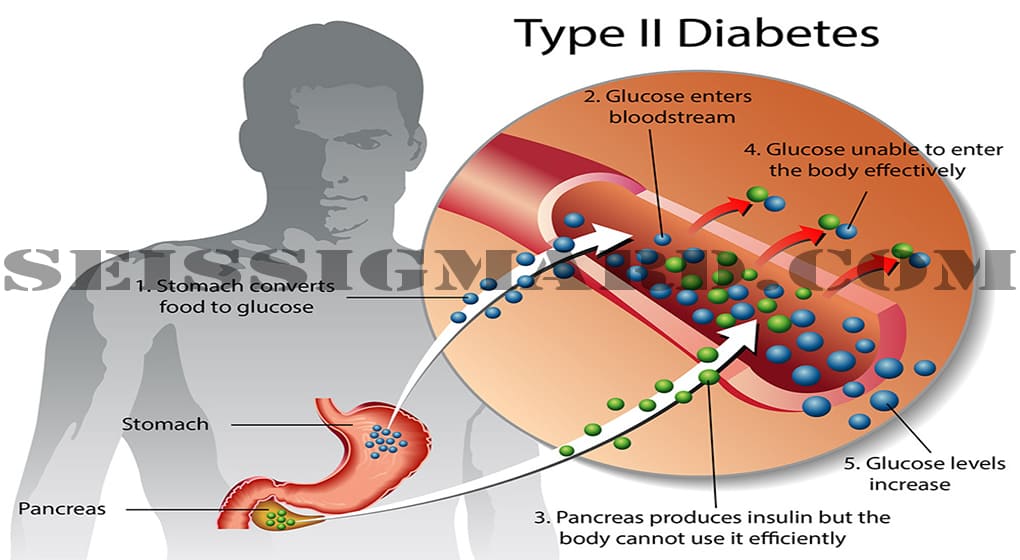 Diabetes Tipe 1 vs Tipe 2: Kenali Perbedaannya - SEISSIGMARD